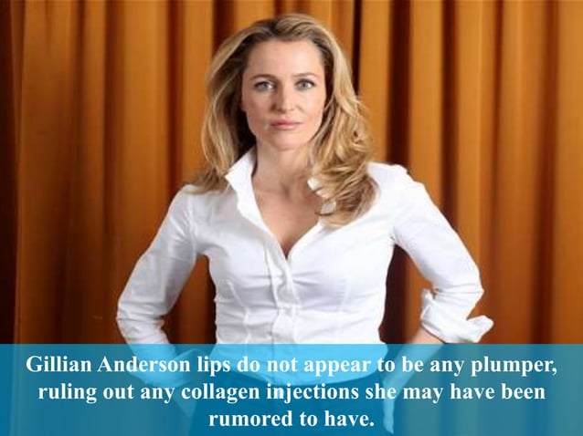 Gillian anderson plastic surgery | PPTX