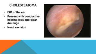 ENT/ Neuro ABSITE review | PPTX