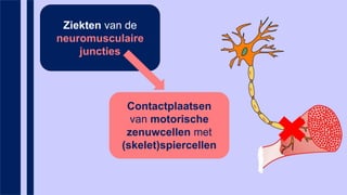 Omkadering voor patiënten met een neuromusculaire aandoening | PPT