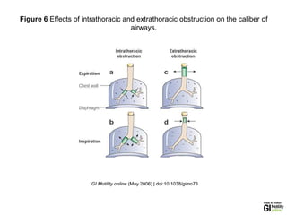 gimo73-pf6.ppt | Lung and Respiratory Health | Diseases and Conditions