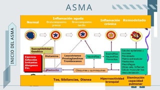 GINA Presentación medicina Asma neumología.pptx