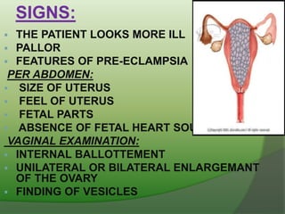 GINCY -VESICULAR MOLE in pregnancy in obstetric and gynecology | PPTX