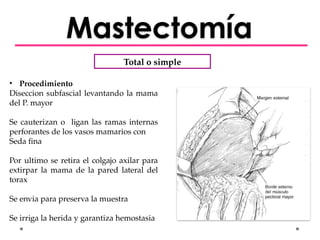 Anatomia quirurgica de la mama cirugia general | PPTX