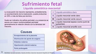 gineco sufrimiento fetal en el parto.pptx