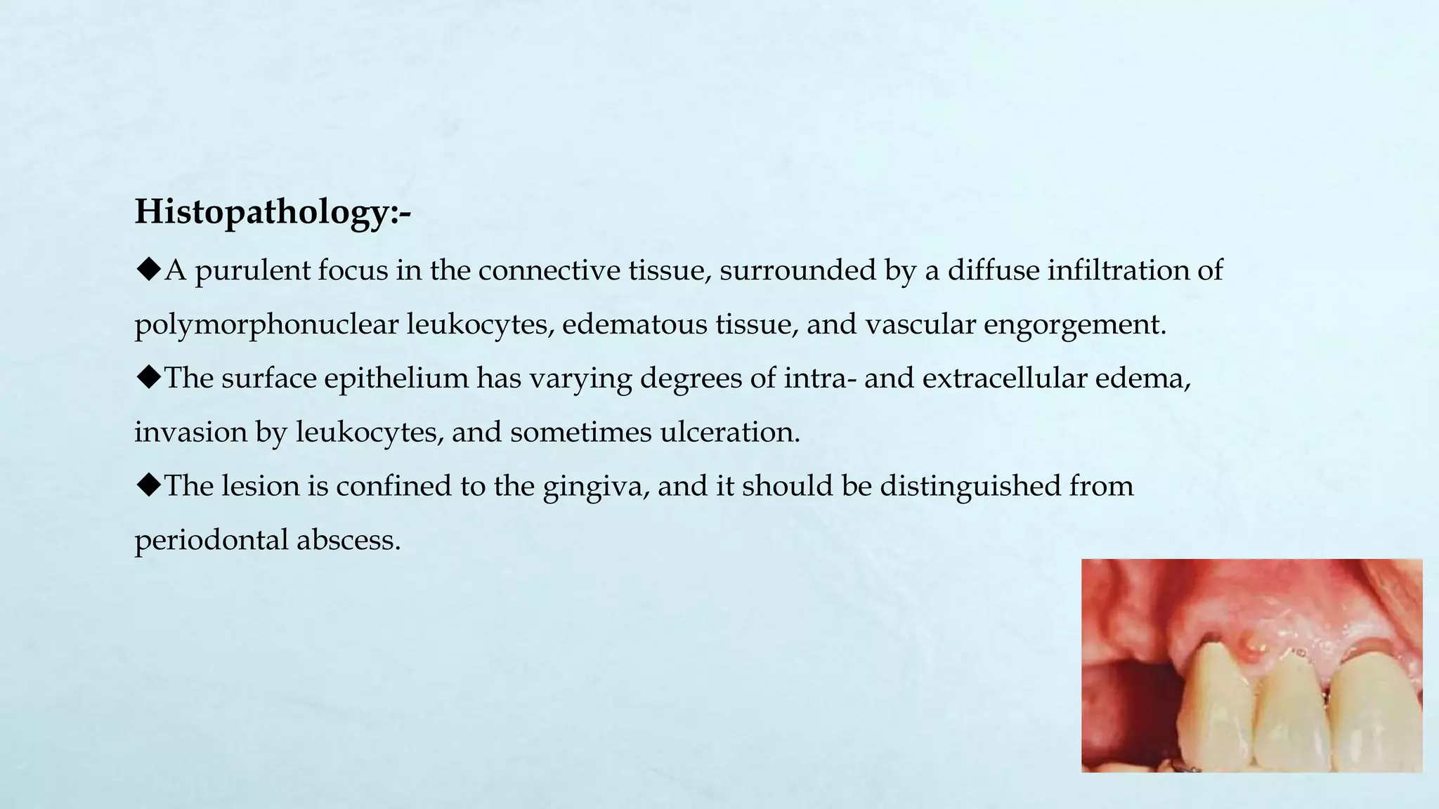 Gingival enlargement | PPTX
