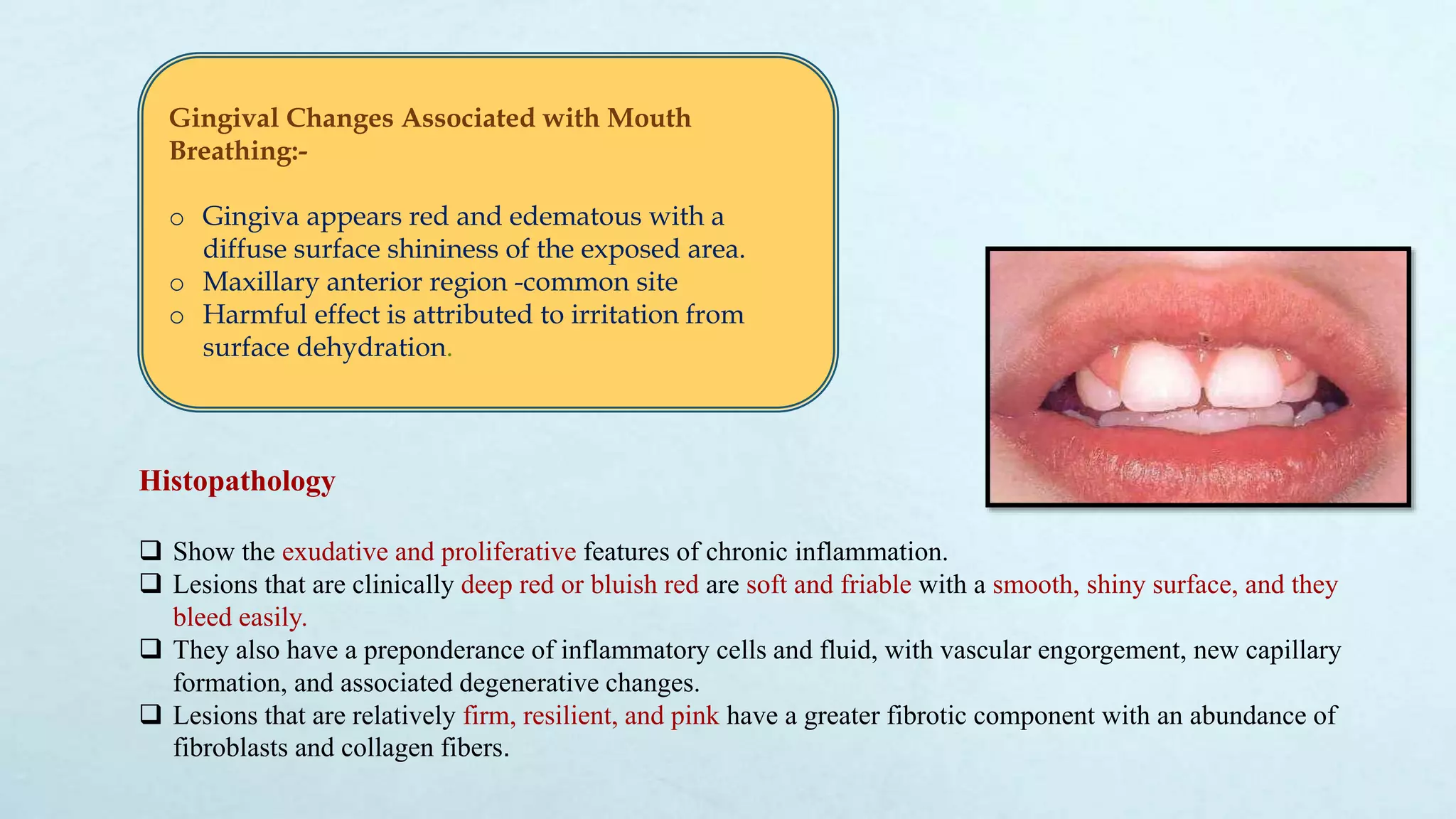 Gingival enlargement | PPTX