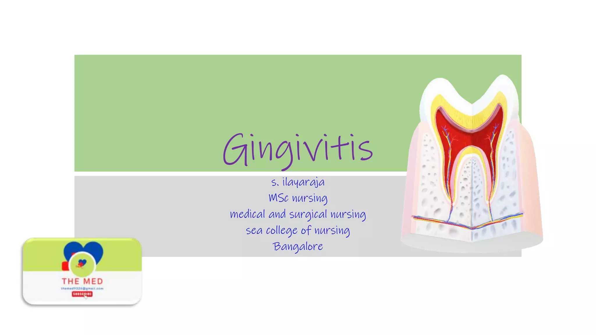 GINGIVITIS | PPTX