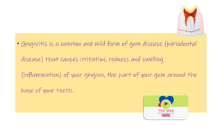 GINGIVITIS | PPTX