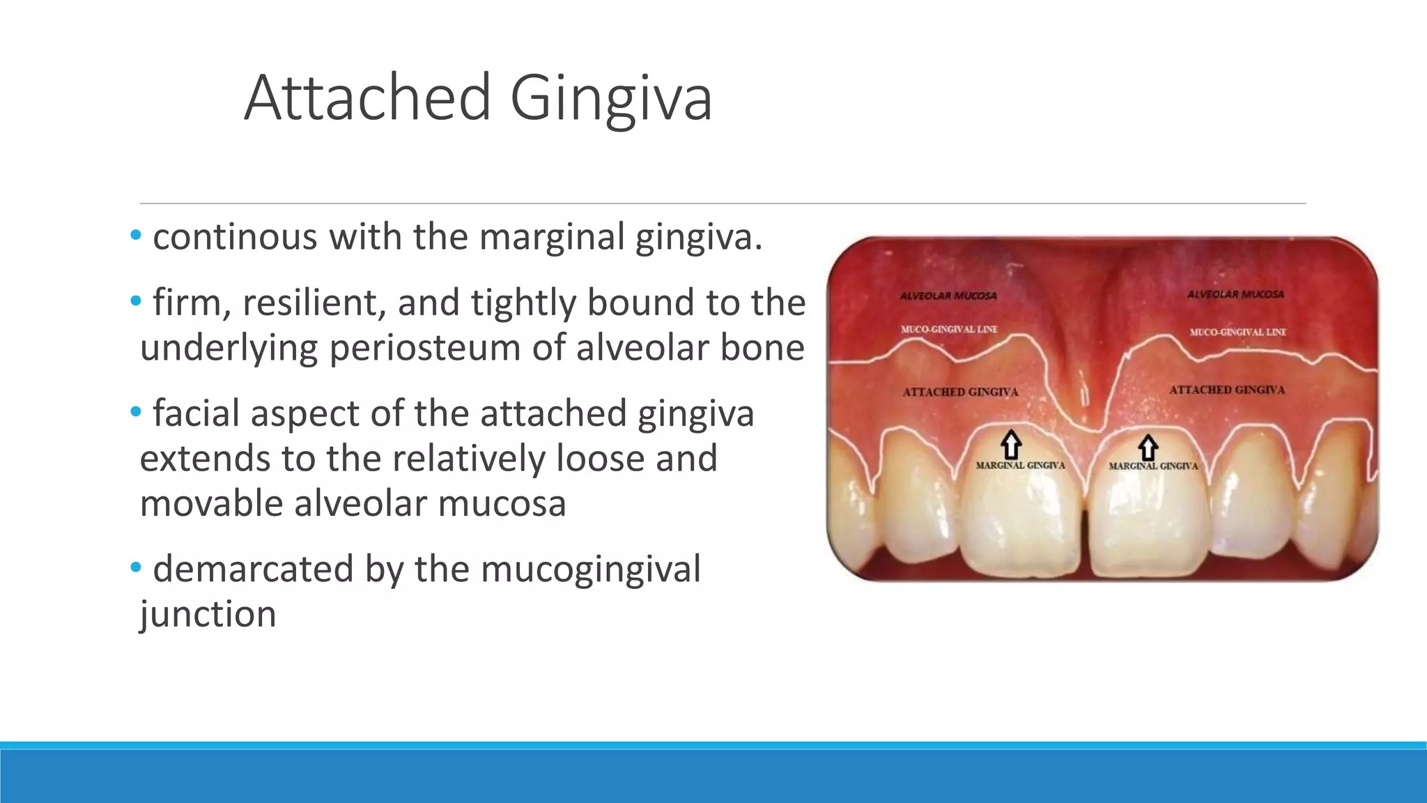 Gingiva | PPTX