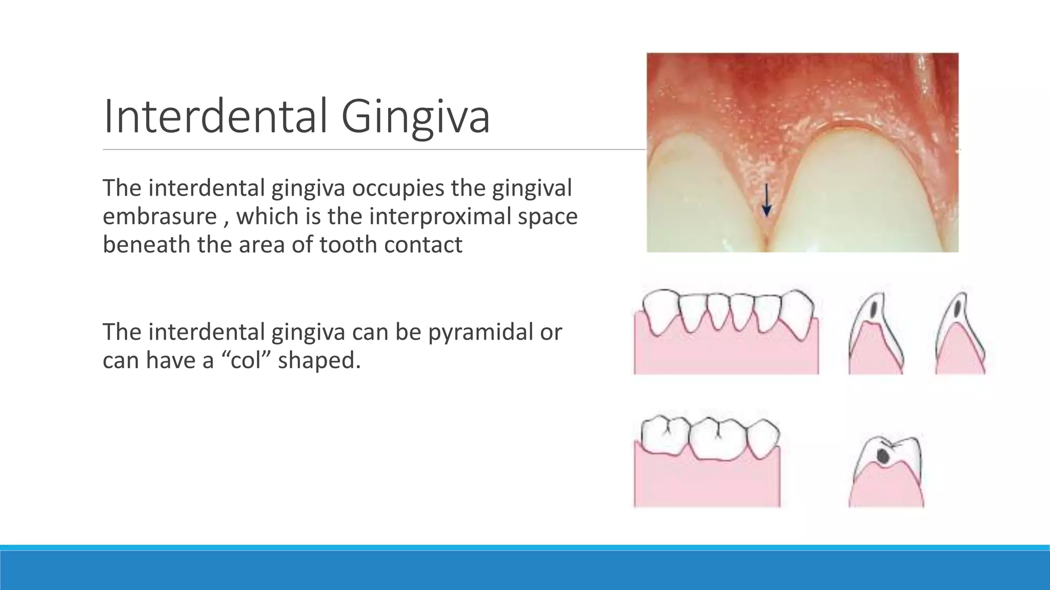 Gingiva | PPTX