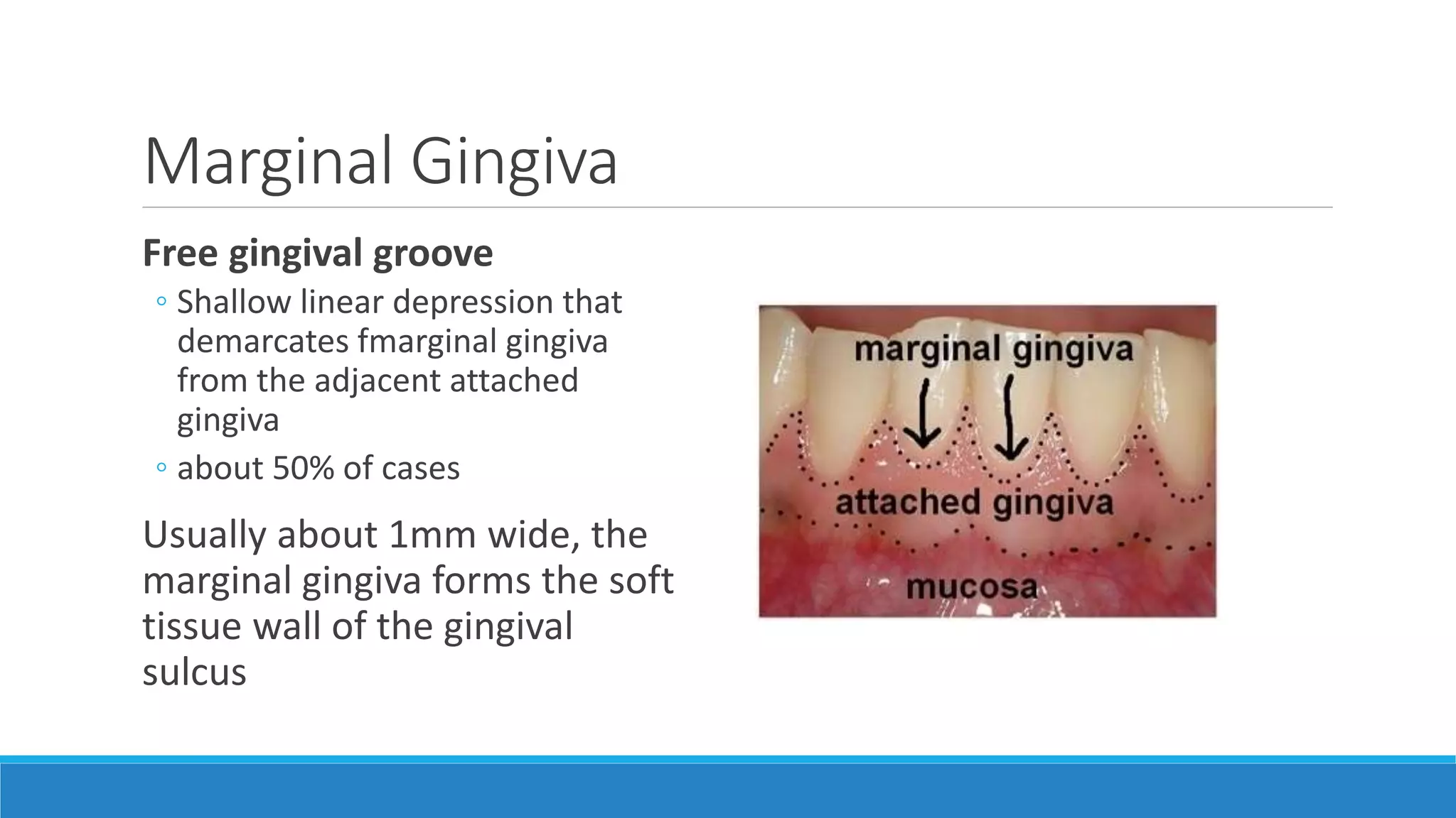 Gingiva | PPTX