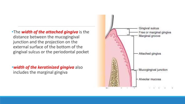Gingiva | PPTX
