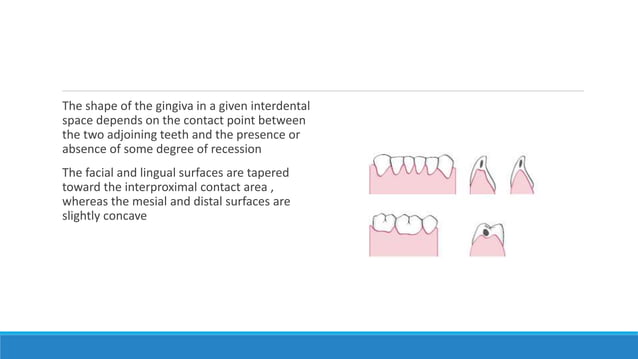 Gingiva | PPTX