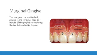 Marginal Gingiva
