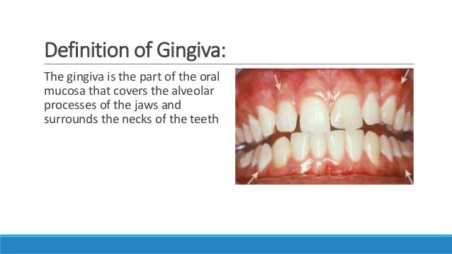 Gingiva
