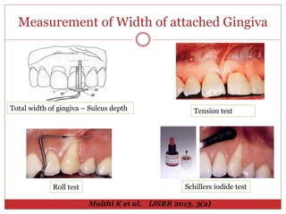 Gingiva | PPTX