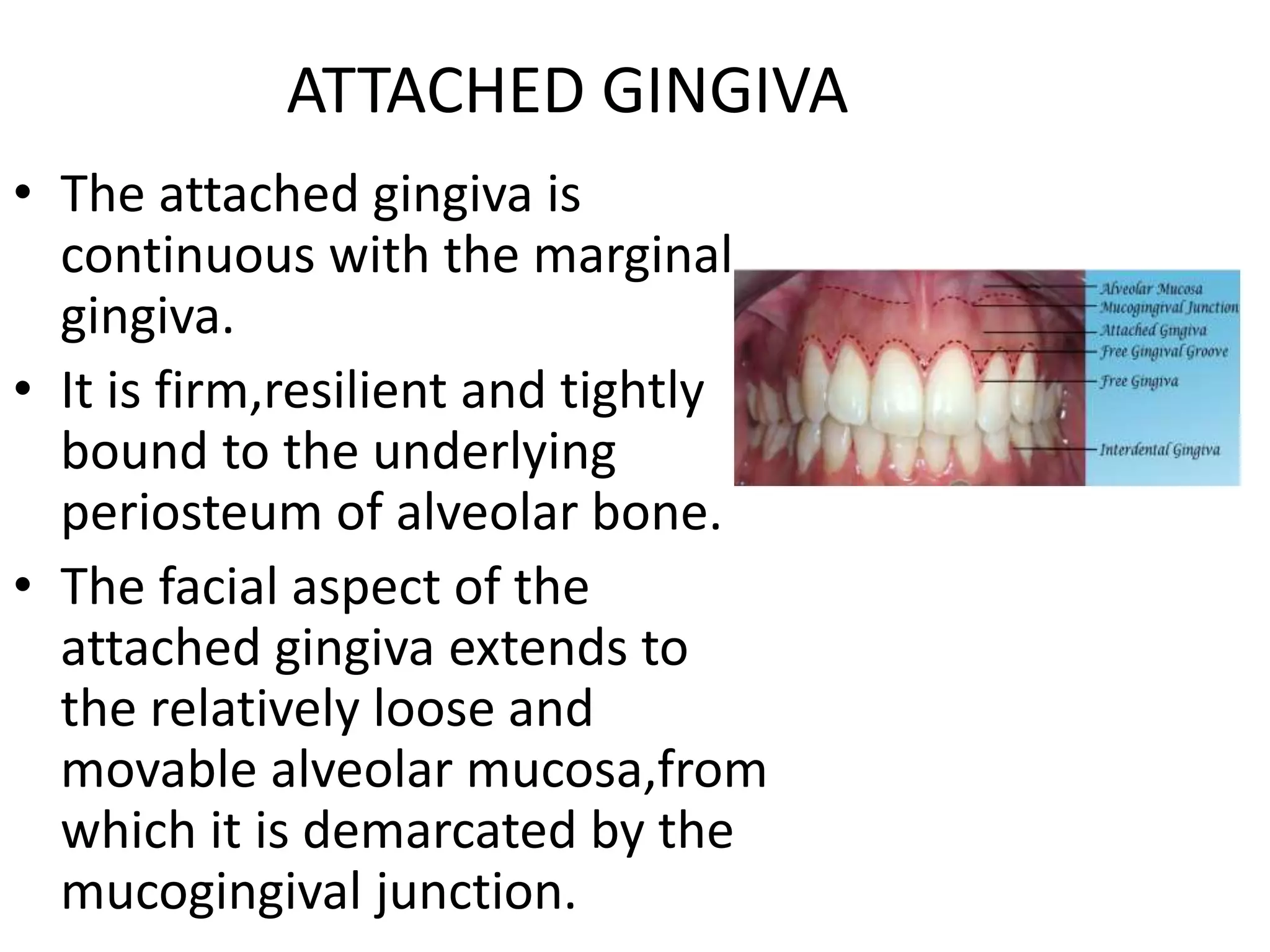 Gingiva | PPTX