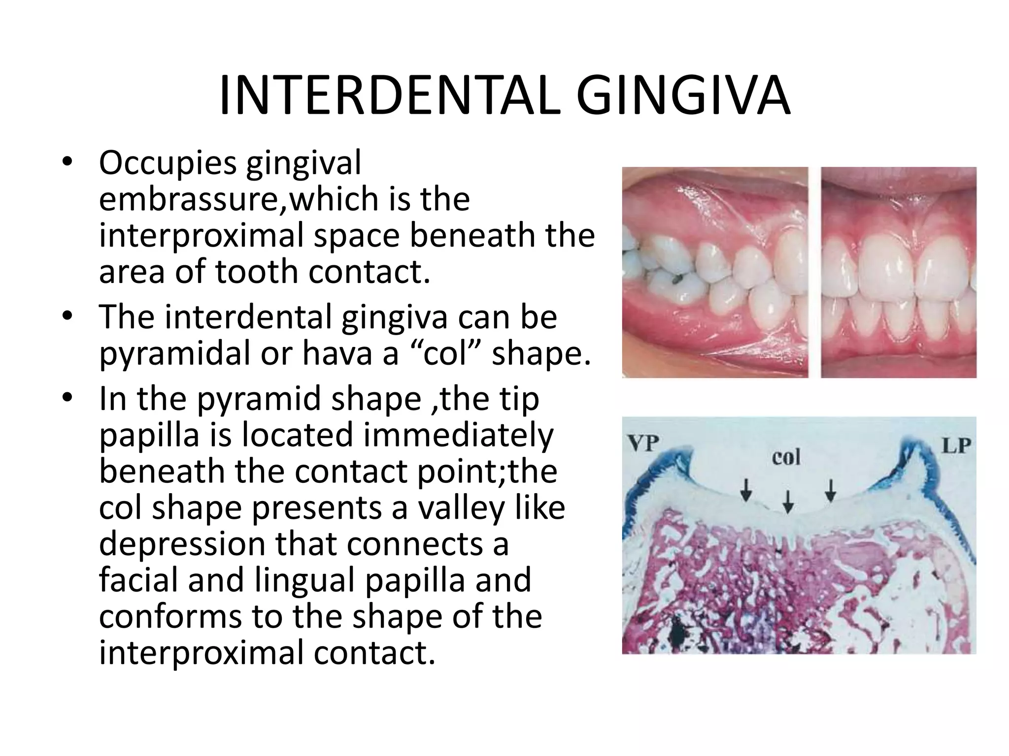 Gingiva | PPTX