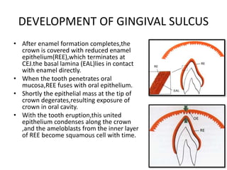 Gingiva | PPTX