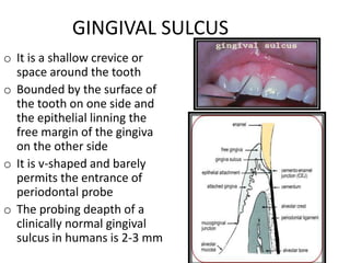 Gingival Sulcus