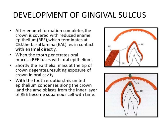 Gingiva