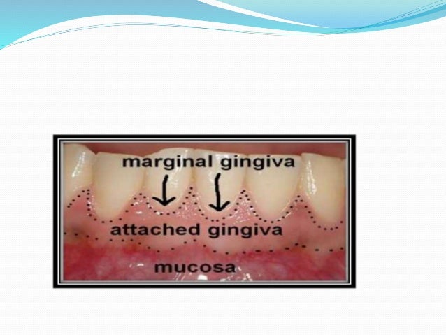 Gingiva