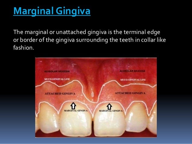 Gingiva