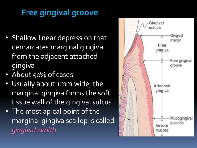 Gingiva