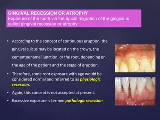 Gingiva.-. Part 1 & 2. Revised1.1.pptx