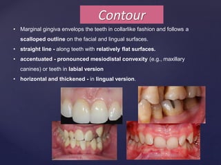 Gingiva.-. Part 1 & 2. Revised1.1.pptx