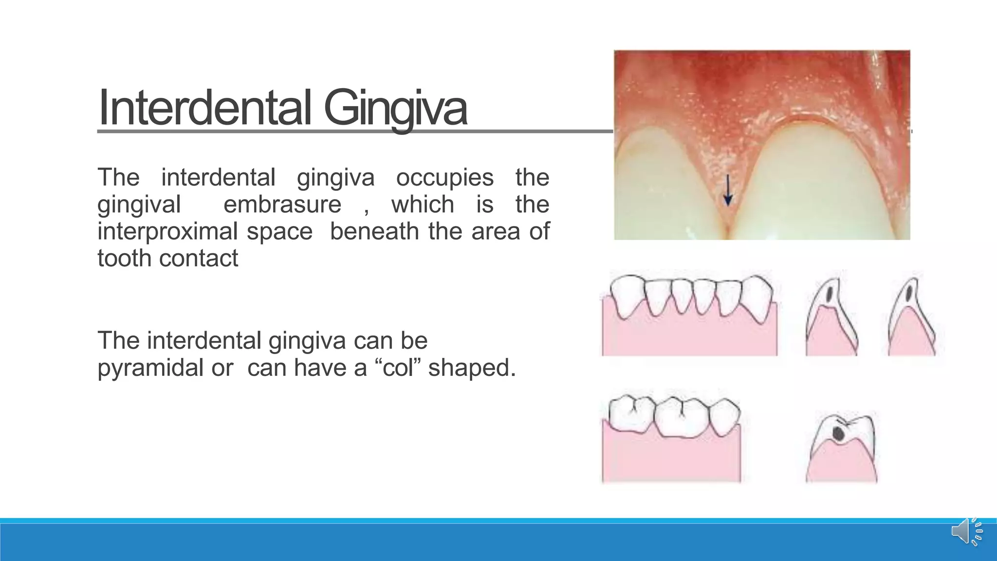 gingiva.pptx