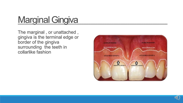 gingiva.pptx