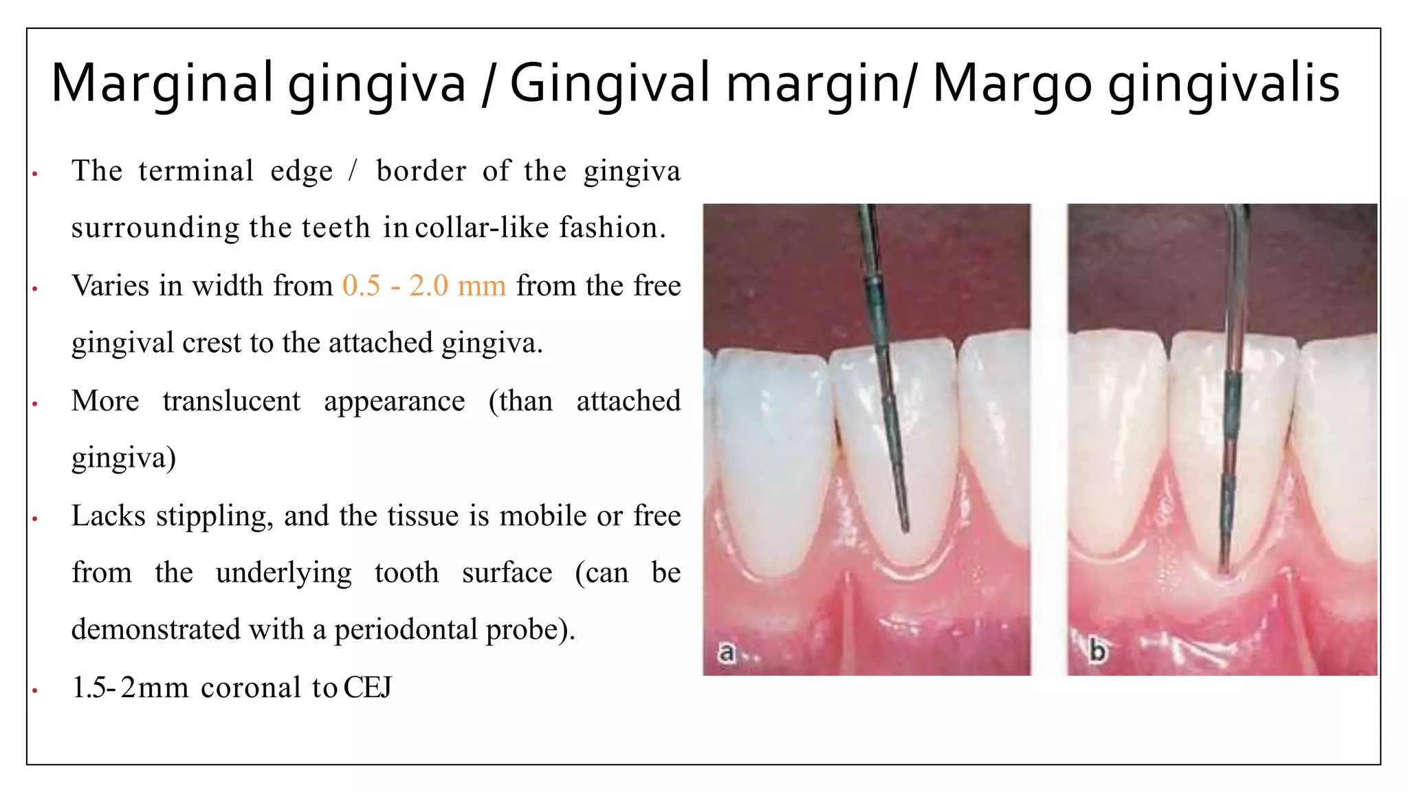 Gingiva Periodontology | PPTX