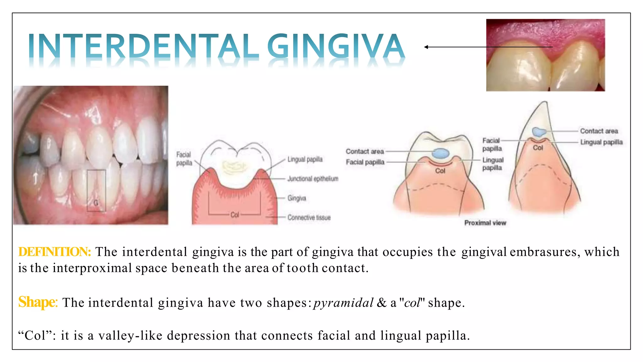 Gingiva Periodontology | PPTX