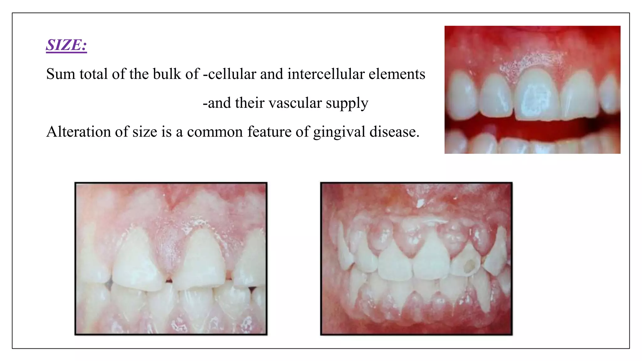 Gingiva Periodontology | PPTX