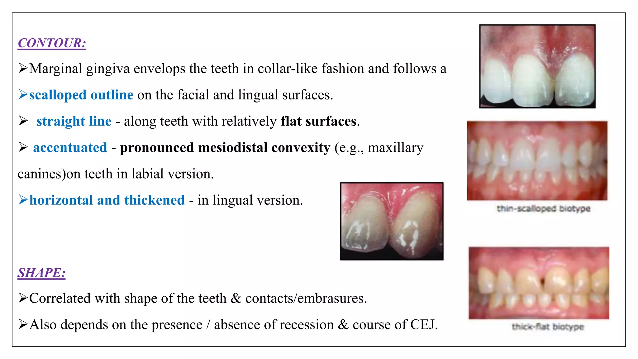 Gingiva Periodontology | PPTX