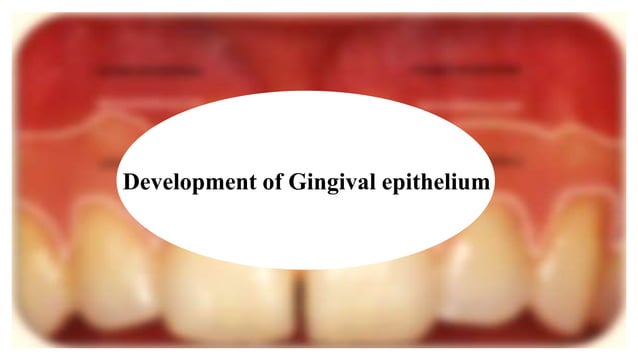 Gingiva Periodontology | PPTX | Dental Health | Diseases and Conditions