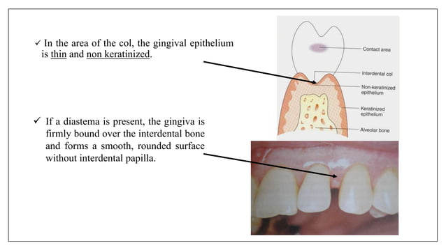 Gingiva Periodontology | PPTX | Dental Health | Diseases and Conditions