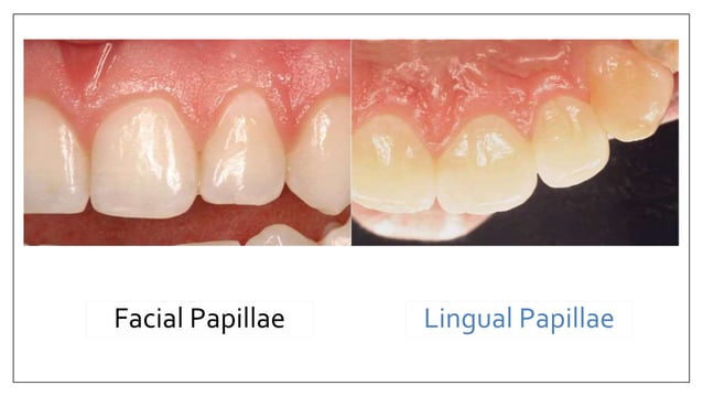 Gingiva Periodontology | PPTX | Dental Health | Diseases and Conditions