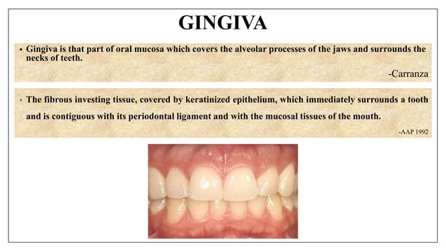 Gingiva Periodontology | PPTX | Dental Health | Diseases and Conditions