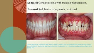 STRUCTURE AND FUNCTION OF GINGIVA IN PERIODONTICS | PPTX