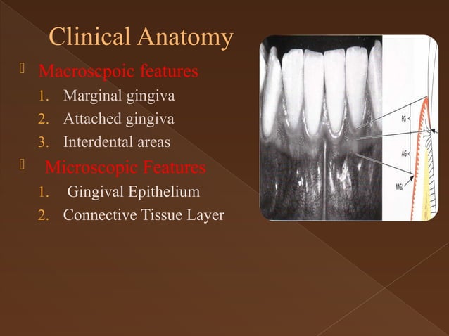 GINGIVA ( the part of periodontium) .pptx