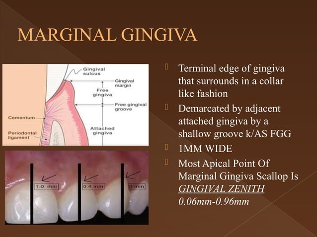 GINGIVA ( the part of periodontium) .pptx