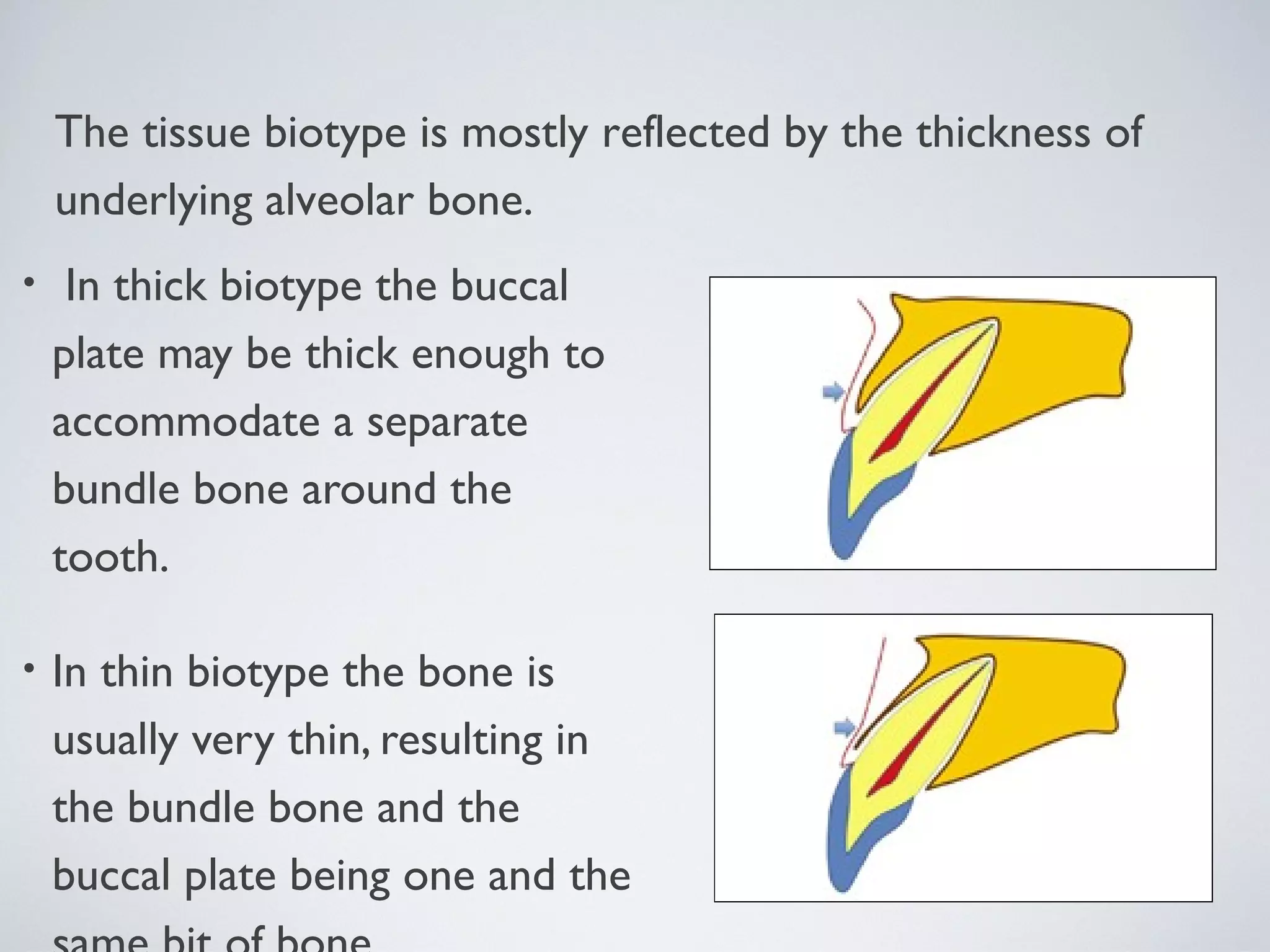 Gingiva biotype | PPT