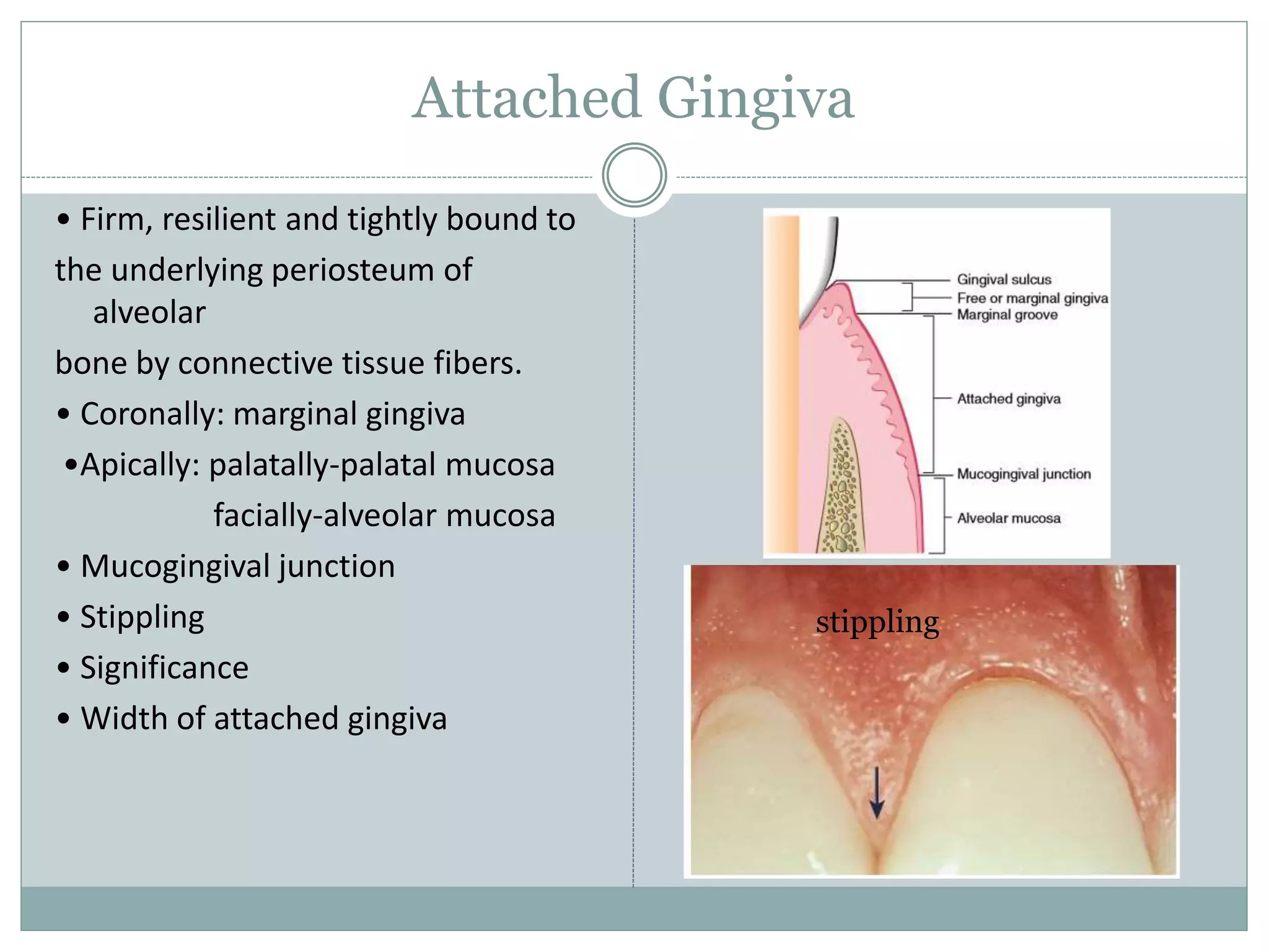 Gingiva | PPTX