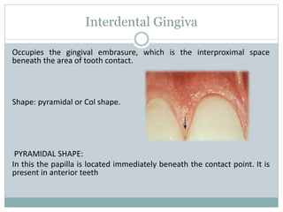 Gingiva | PPTX