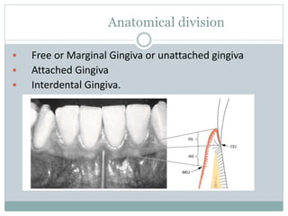 Gingiva | PPTX