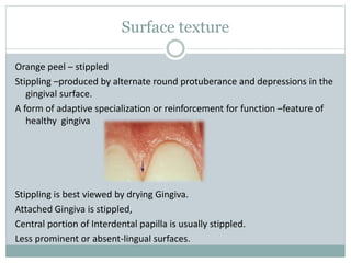 Normal Gum Stippling