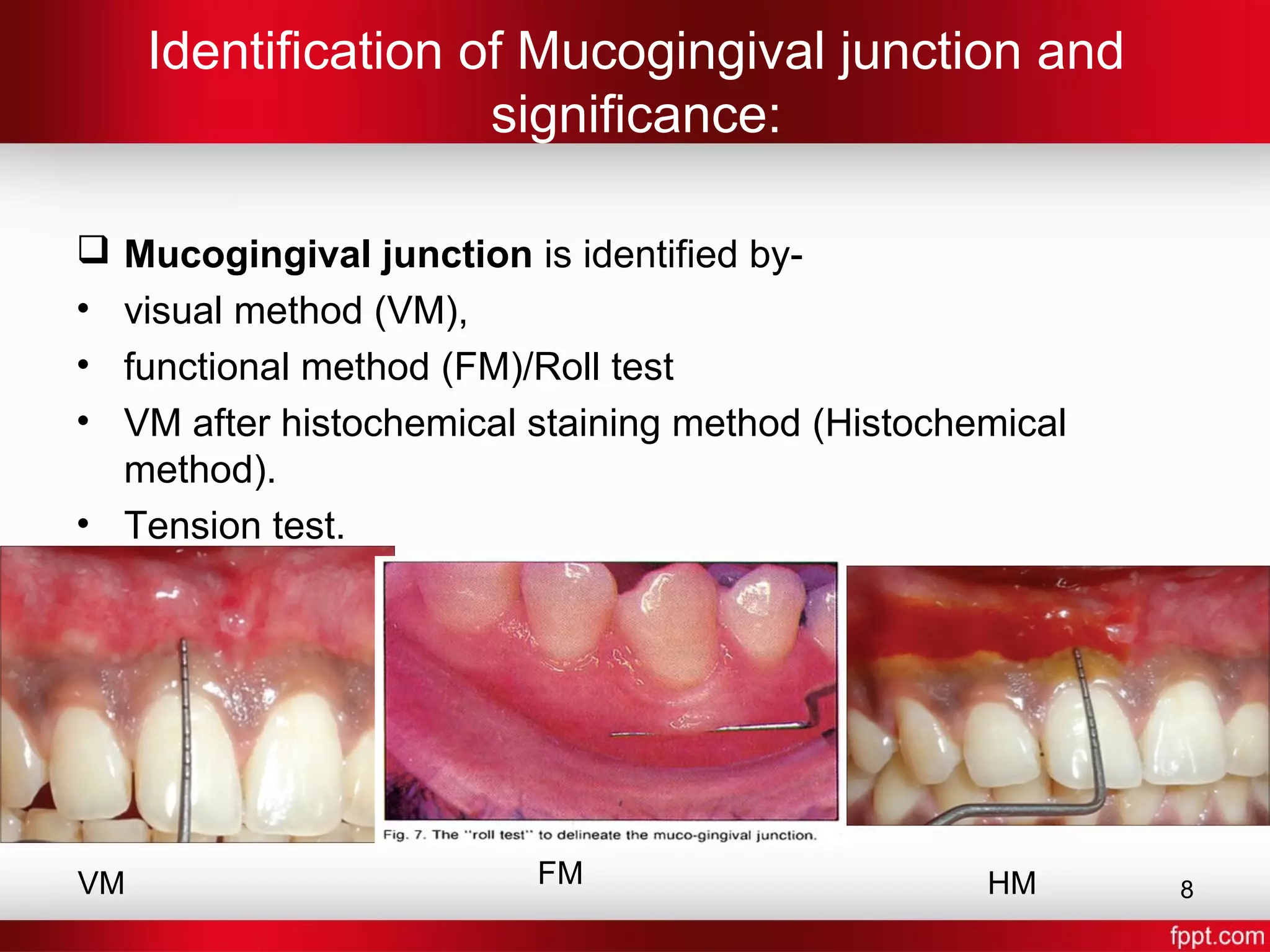 Gingiva in health and disease | PPT