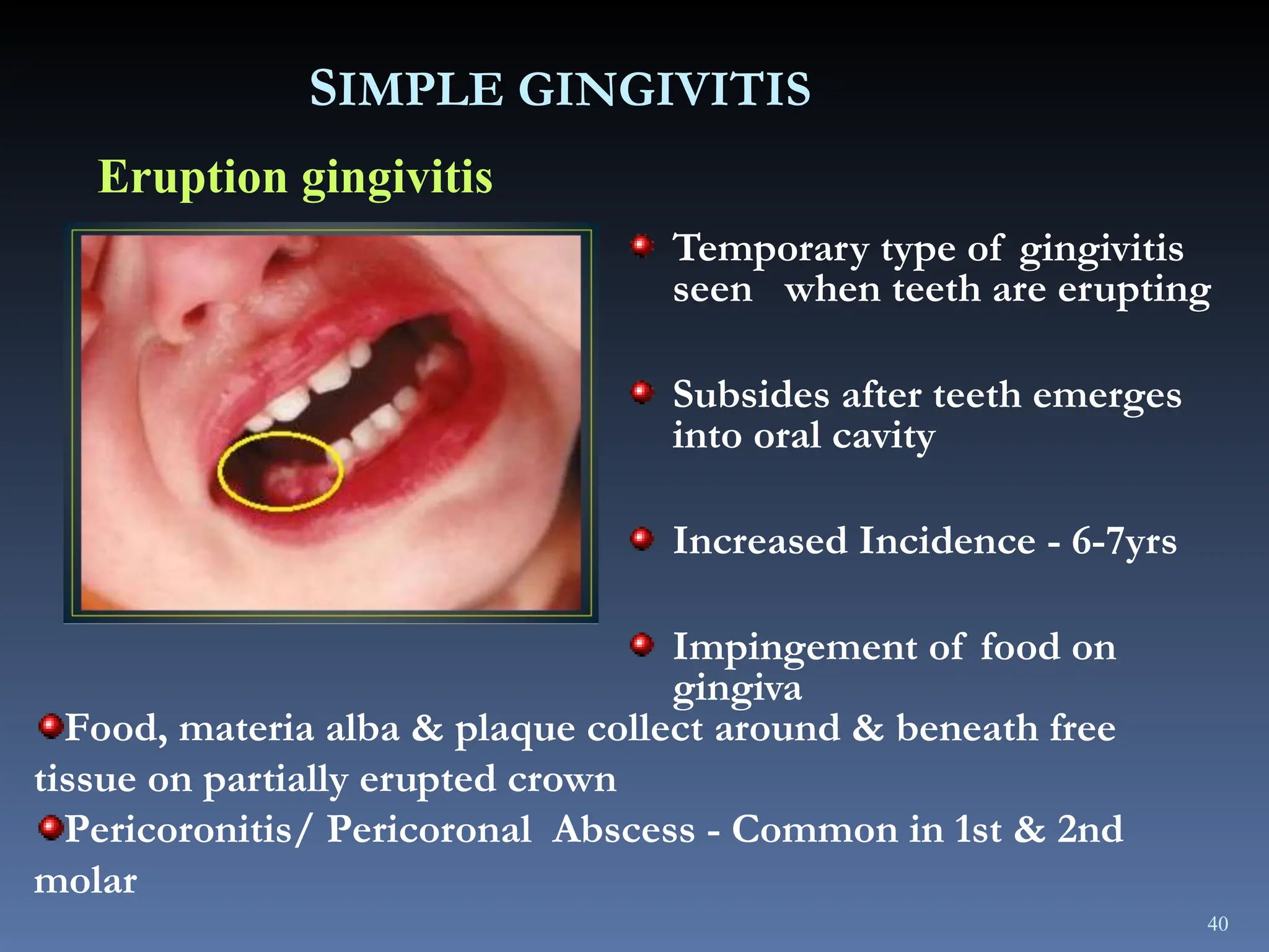 GINGIVAL AND PERIODONTAL DISEASES IN CHILDREN - Dr K. Harish.ppt